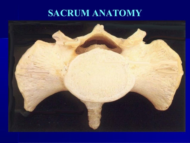 Sacral injuries