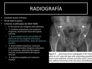 Radiografía De La Articulación Sacroilíaca Normal