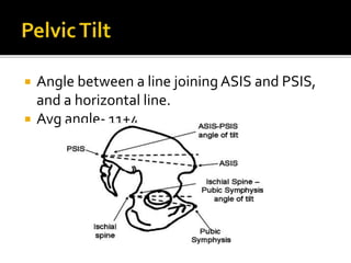 SACROILIAC JOINT- assessment.pptx