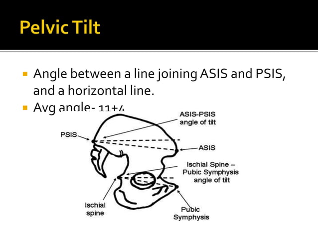 SACROILIAC JOINT- assessment.pptx