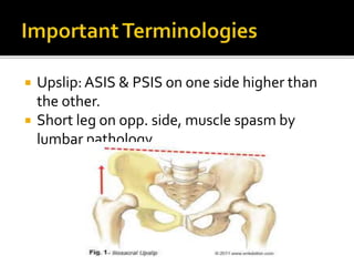SACROILIAC JOINT- assessment.pptx