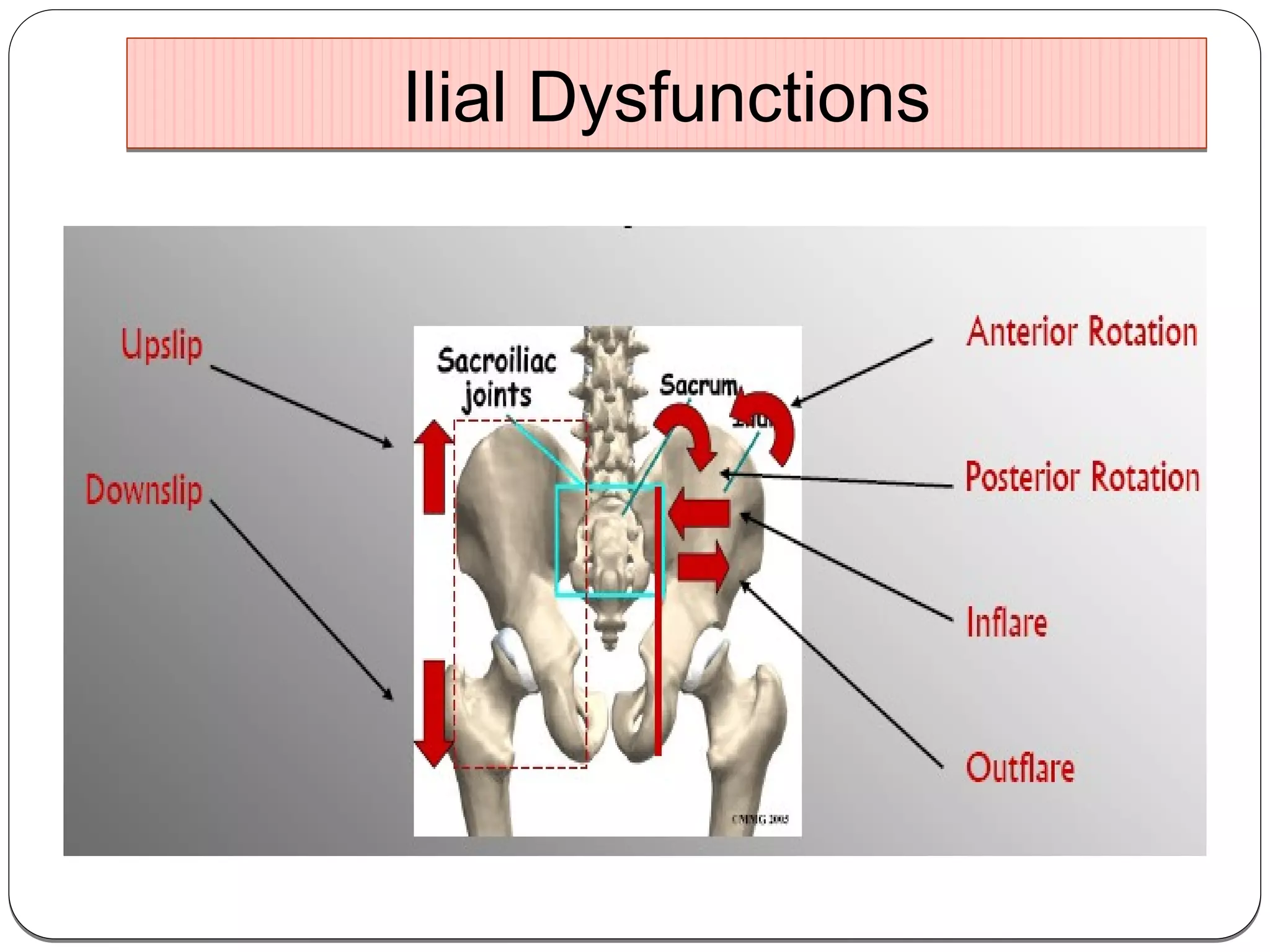 Sacroiliac joint biomechanics, dysfunctions, assessment and its manual ...