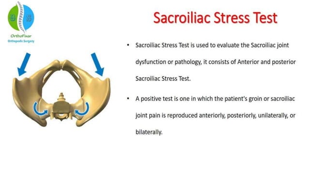 SACROILIAC JOINT DYSFUNCTIO.pptx