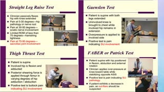 Sacroiliac joint dysfunction | PPTX