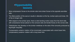 Sacroiliac joint dysfunction | PPTX