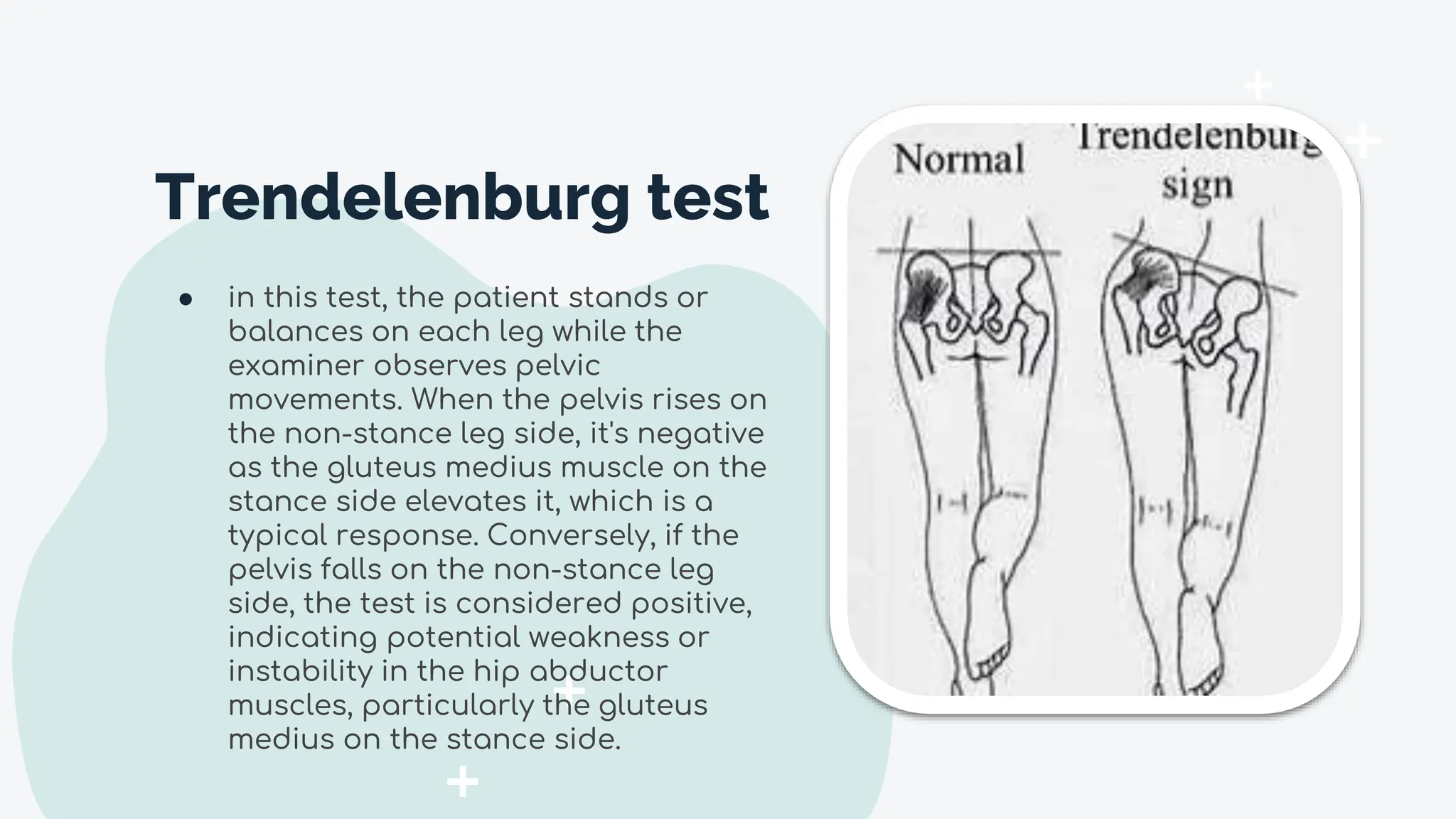 Sacroiliac joint special test.pptx