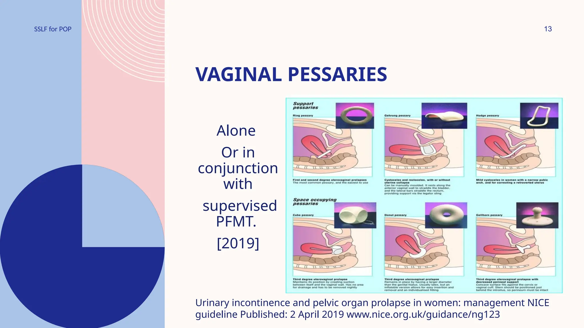 Sacrospinous Ligament Fixation for Pelvic Organ Prolapse - Latest ...