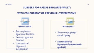Sacrospinous Ligament Fixation for Pelvic Organ Prolapse - Latest ...