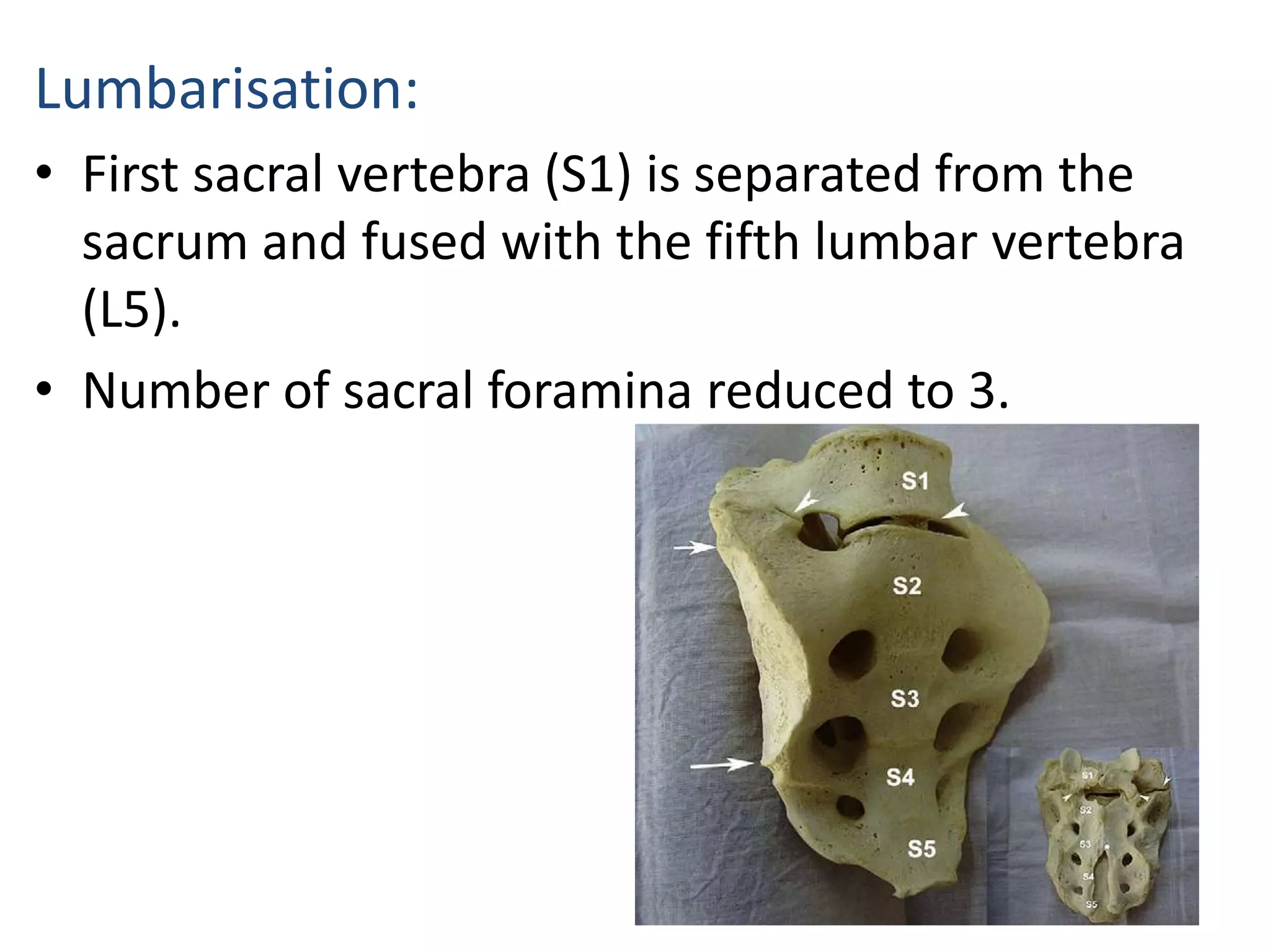 Sacrum | PPTX