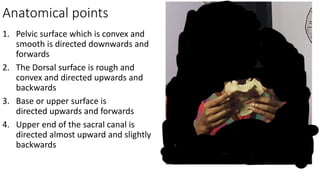 Sacrum | PPTX
