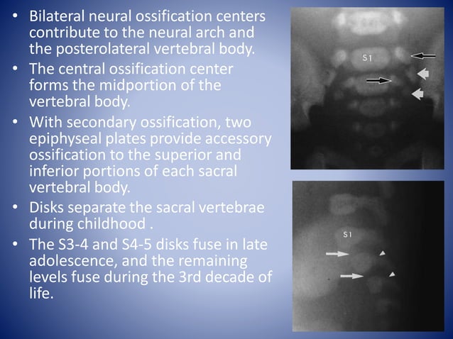Sacrum | PPTX | Pregnancy | Reproductive Health