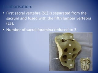 Sacrum | PPTX | Pregnancy | Reproductive Health