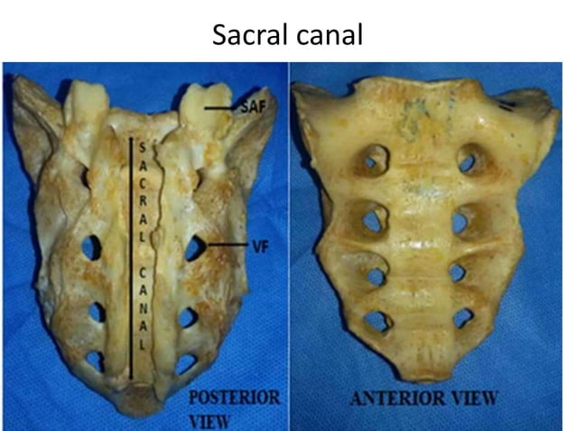 SACRUM ANATOMY.pptx | Death, Injury, or Military Conflict | Sensitive ...