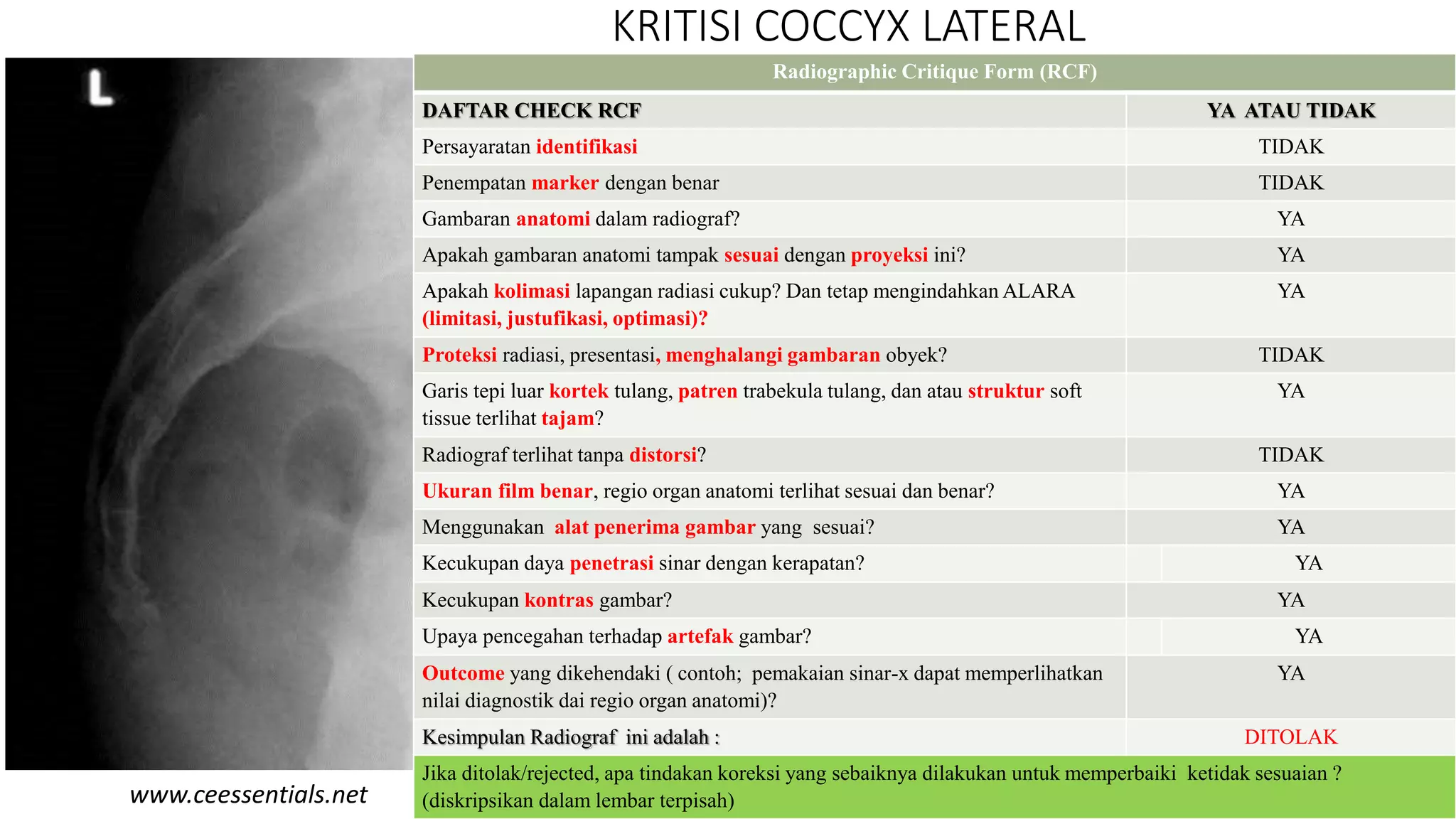 ppt kritisi dan evaluasi radiograf Sacrum dan coccyx | PPTX