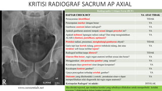 ppt kritisi dan evaluasi radiograf Sacrum dan coccyx | PPTX