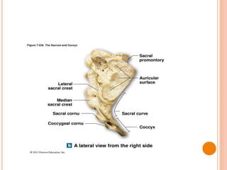 Lateral Sacral Crest