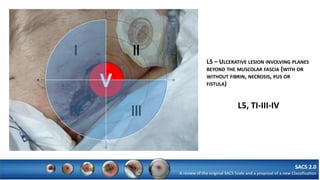 Sacs 2.0 a review of the original sacs scale WUWHS Florence 29.09.2016