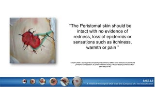 Sacs 2.0 a review of the original sacs scale WUWHS Florence 29.09.2016