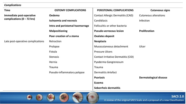 Sacs 2.0 a review of the original sacs scale WUWHS Florence 29.09.2016