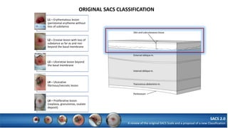 Sacs 2.0 a review of the original sacs scale WUWHS Florence 29.09.2016