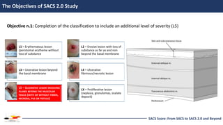 Sacs score from sacs to sacs 2.0 and beyond oral presentation_mario ...