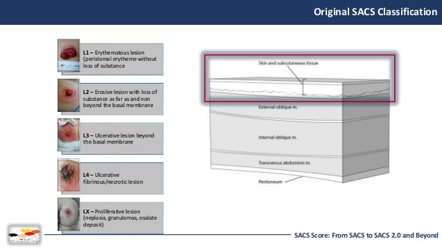 Sacs score from sacs to sacs 2.0 and beyond oral presentation_mario a…