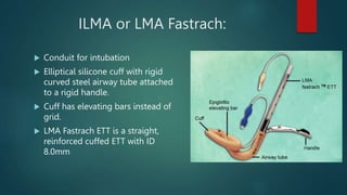 Supra glotic Airway Devices notes .pptx