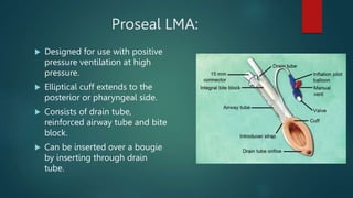 Supra glotic Airway Devices notes .pptx