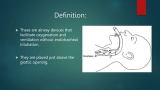 Supra glotic Airway Devices notes .pptx