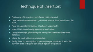 Supra glotic Airway Devices notes .pptx