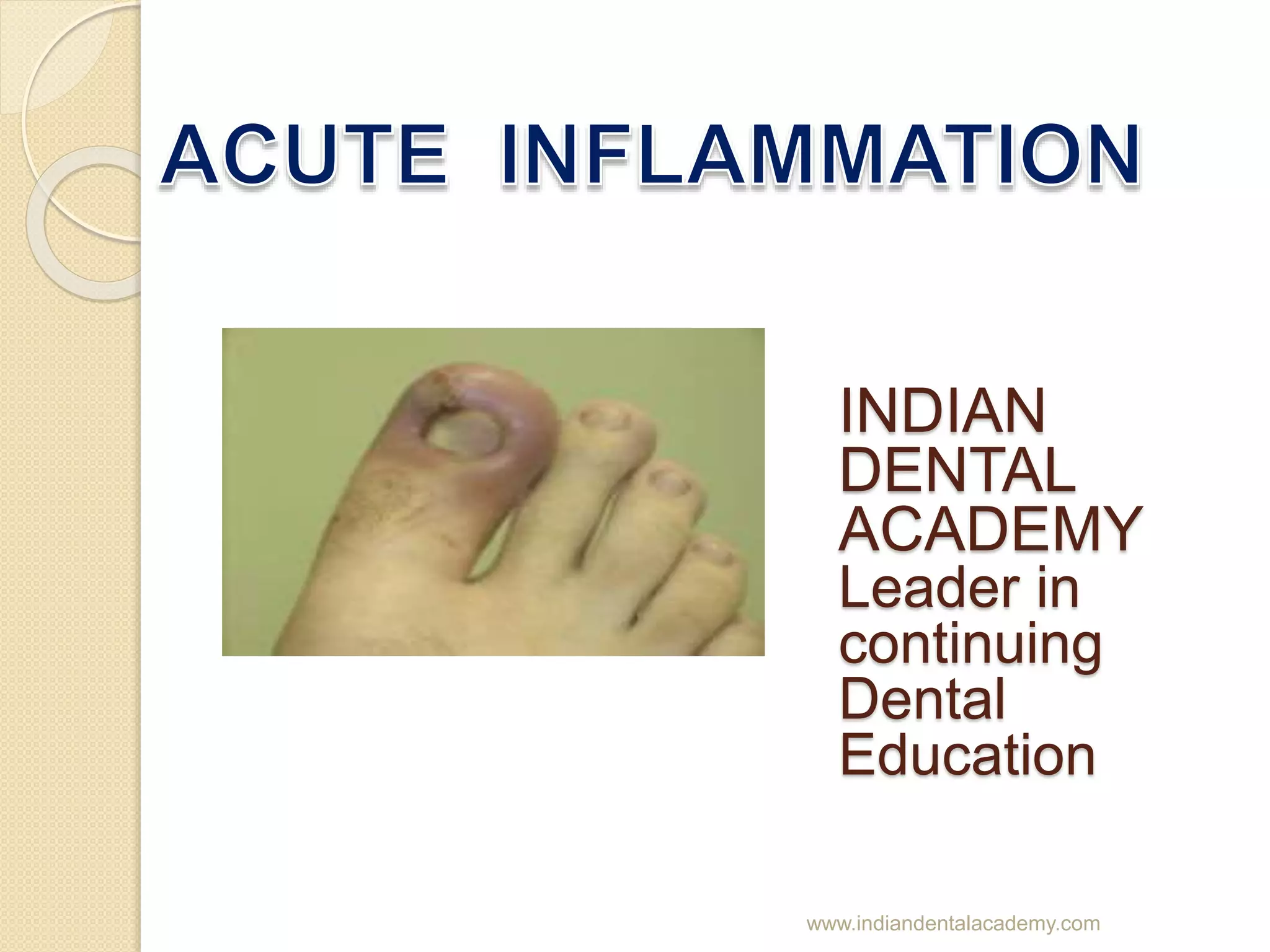 acute inflammation | PPT