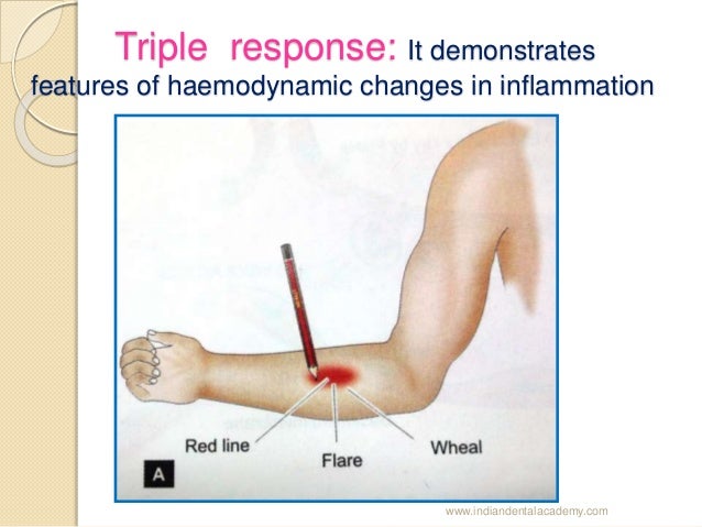 acute inflammation