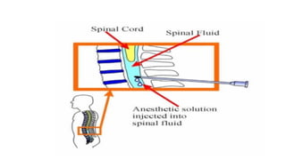 Saddle block dedi.pptxhgchgfhgvhjhgjhgjyhgjyhgu | PPT