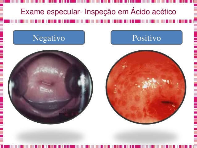 Vulvoscopia – Patologia Vs Diagnóstico