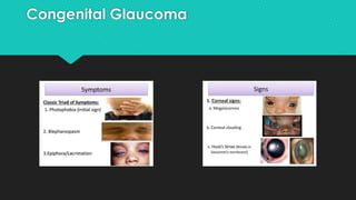 open and close types of Glaucoma ‌of eye | PPTX