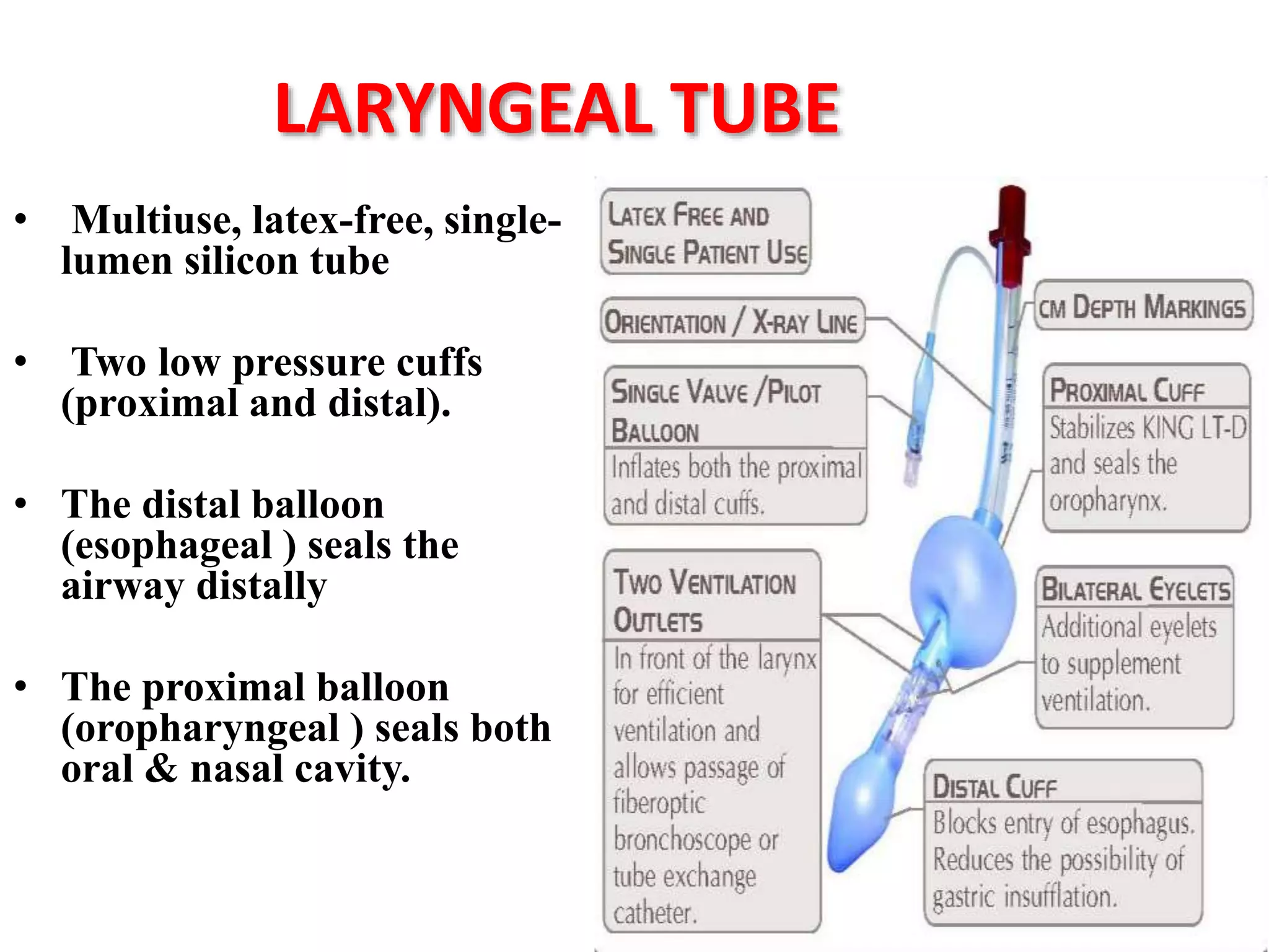 supraglottic airway devices | PPTX