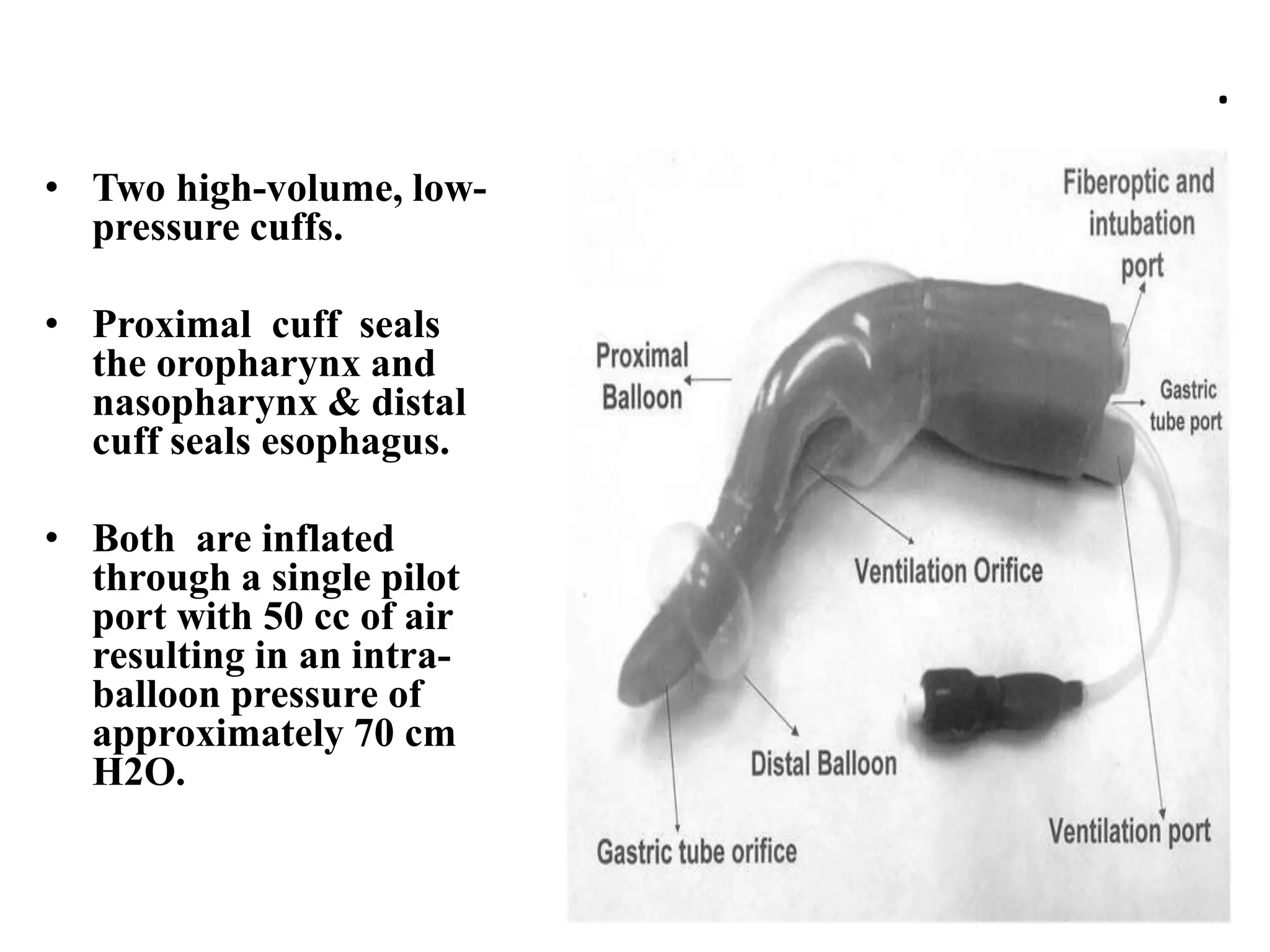 supraglottic airway devices | PPTX