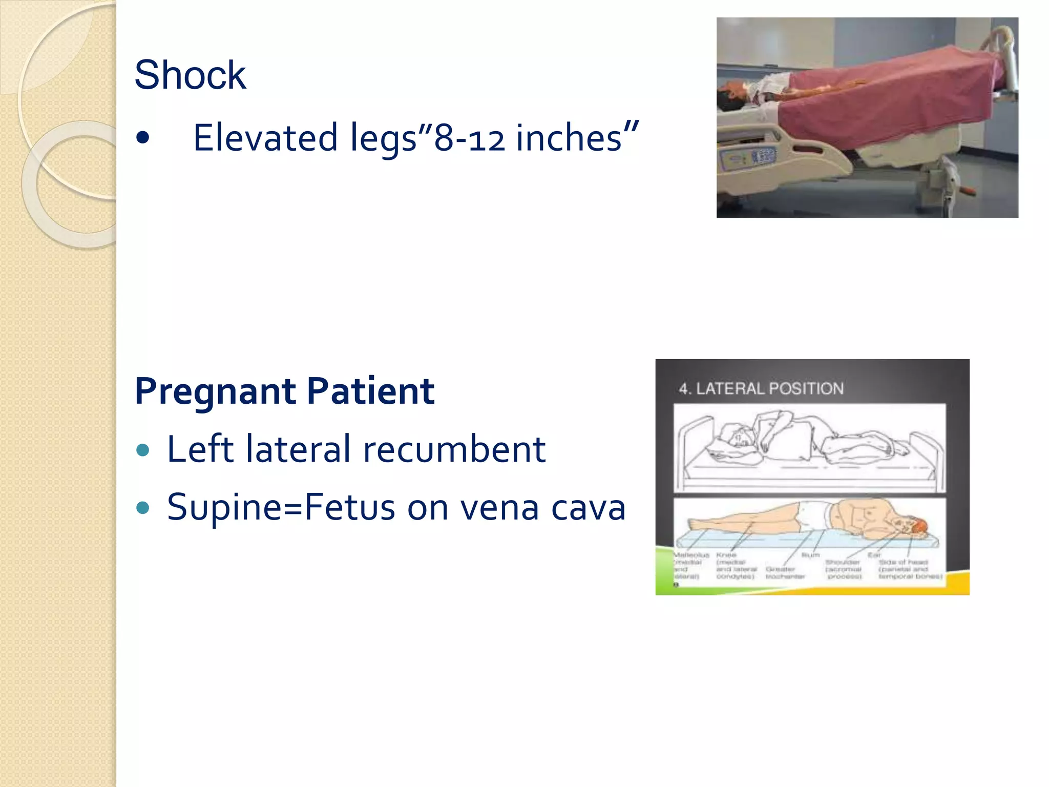 Safe transfer of patient | PPTX