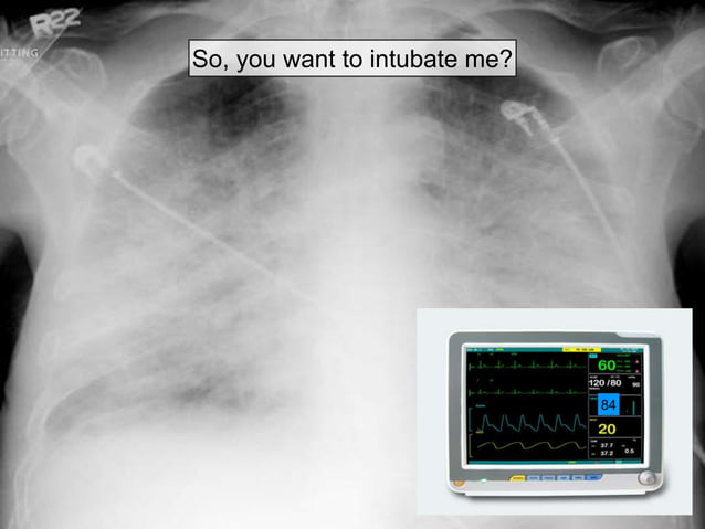 Safe apnea time - by Jason Greenman MD | PPT