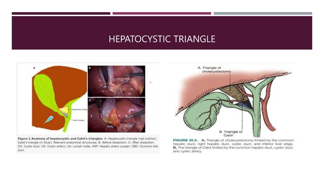 Safe cholecystectomy.pptx | Digestive Disorders | Diseases and Conditions