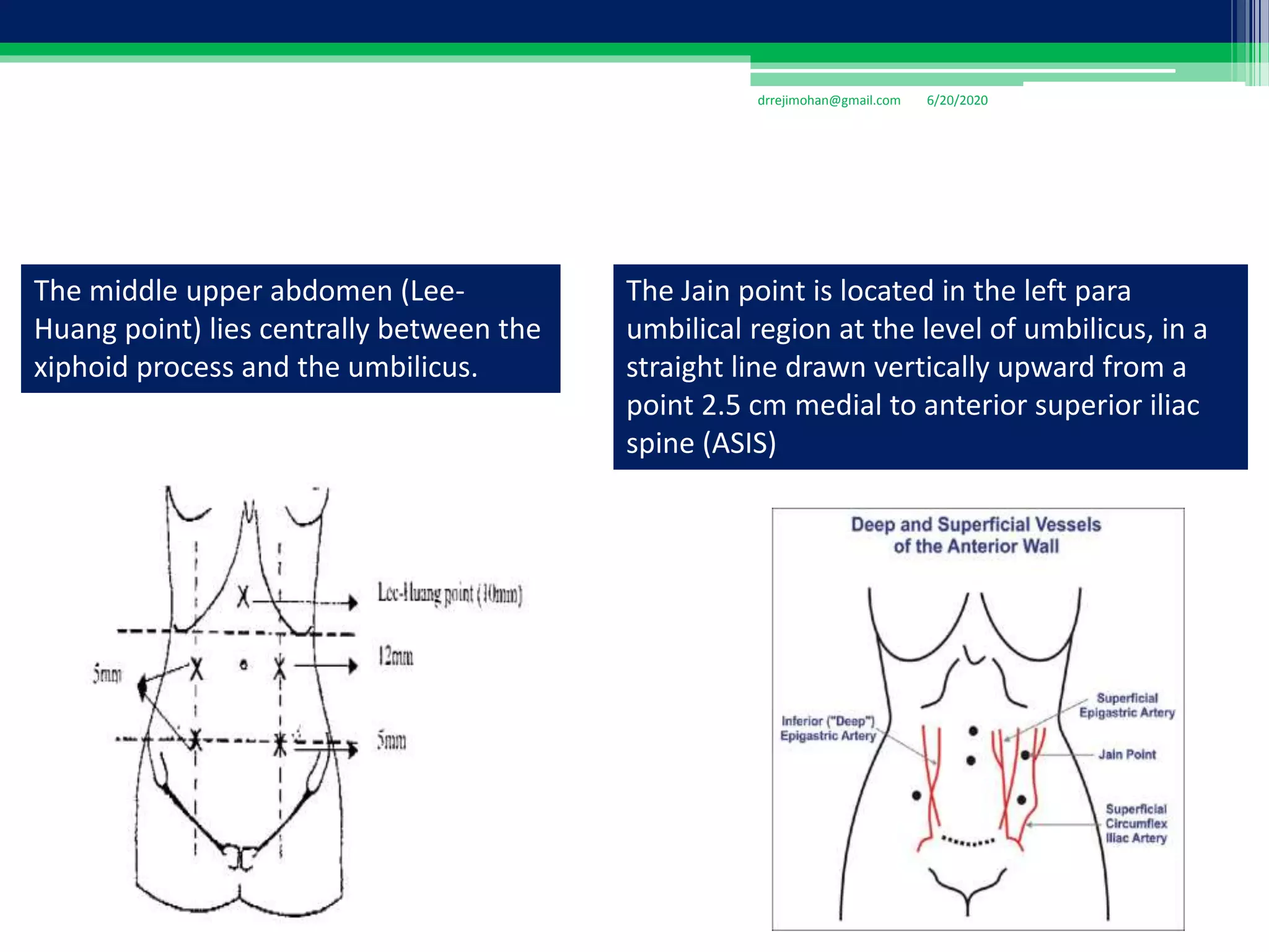 Safe entry in gyn endoscopy | PPT