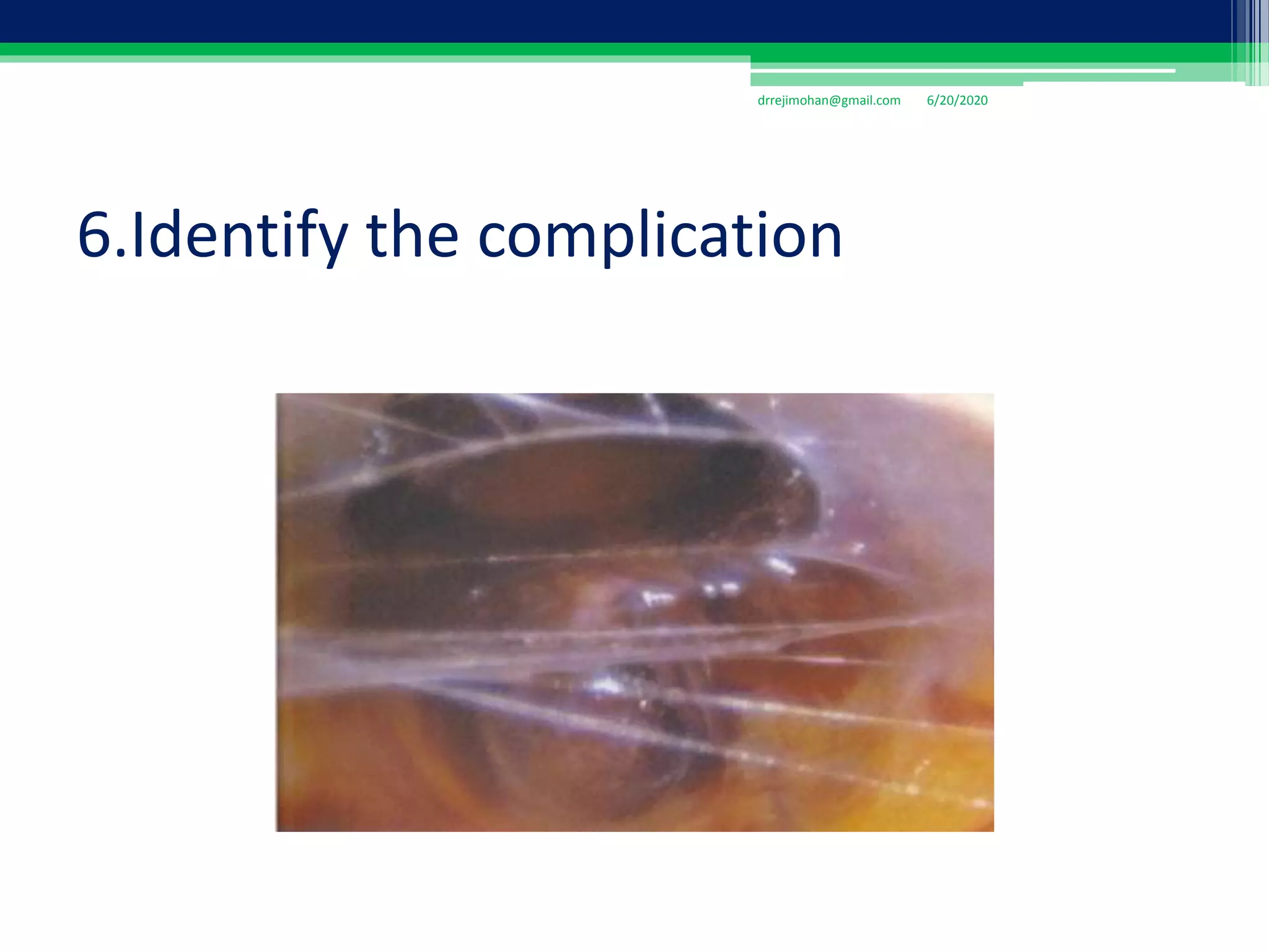 Safe entry in gyn endoscopy | PPT