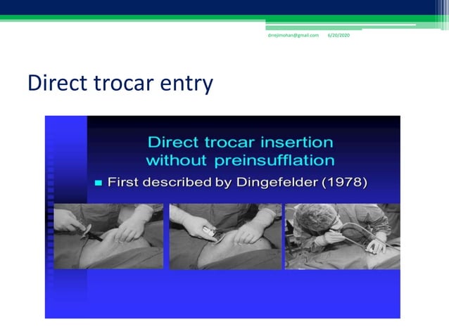 Safe entry in gyn endoscopy | PPT