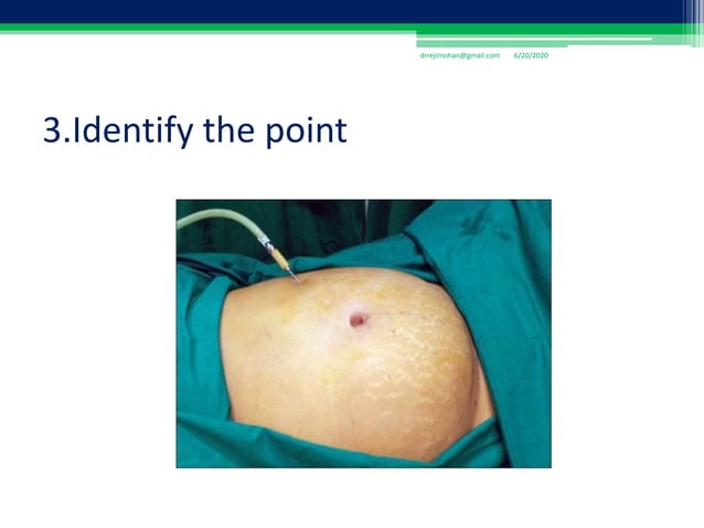Safe entry in gyn endoscopy | PPT
