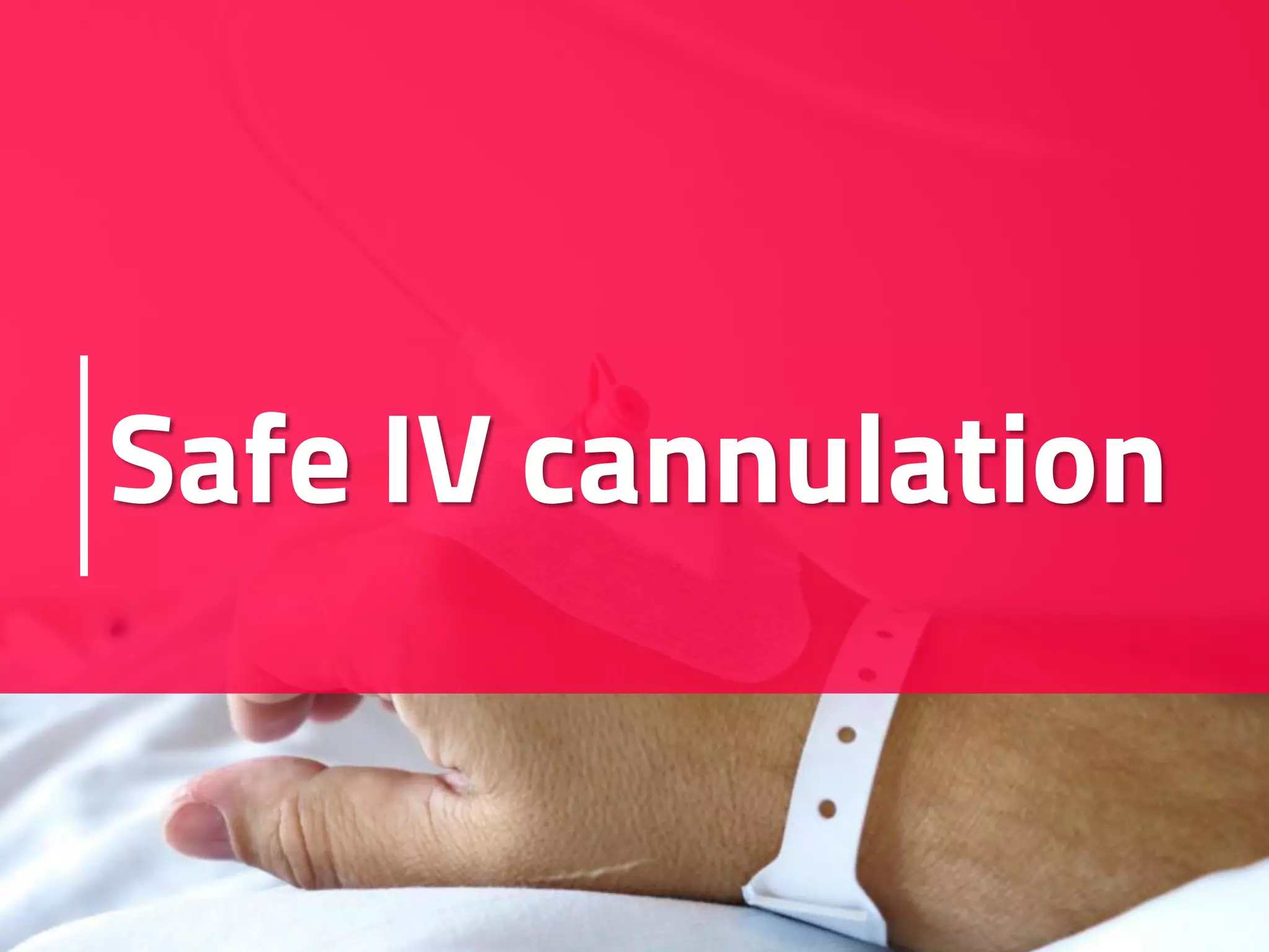 Safe iv cannulation (prevention of iv thrombophlebitis) | PDF