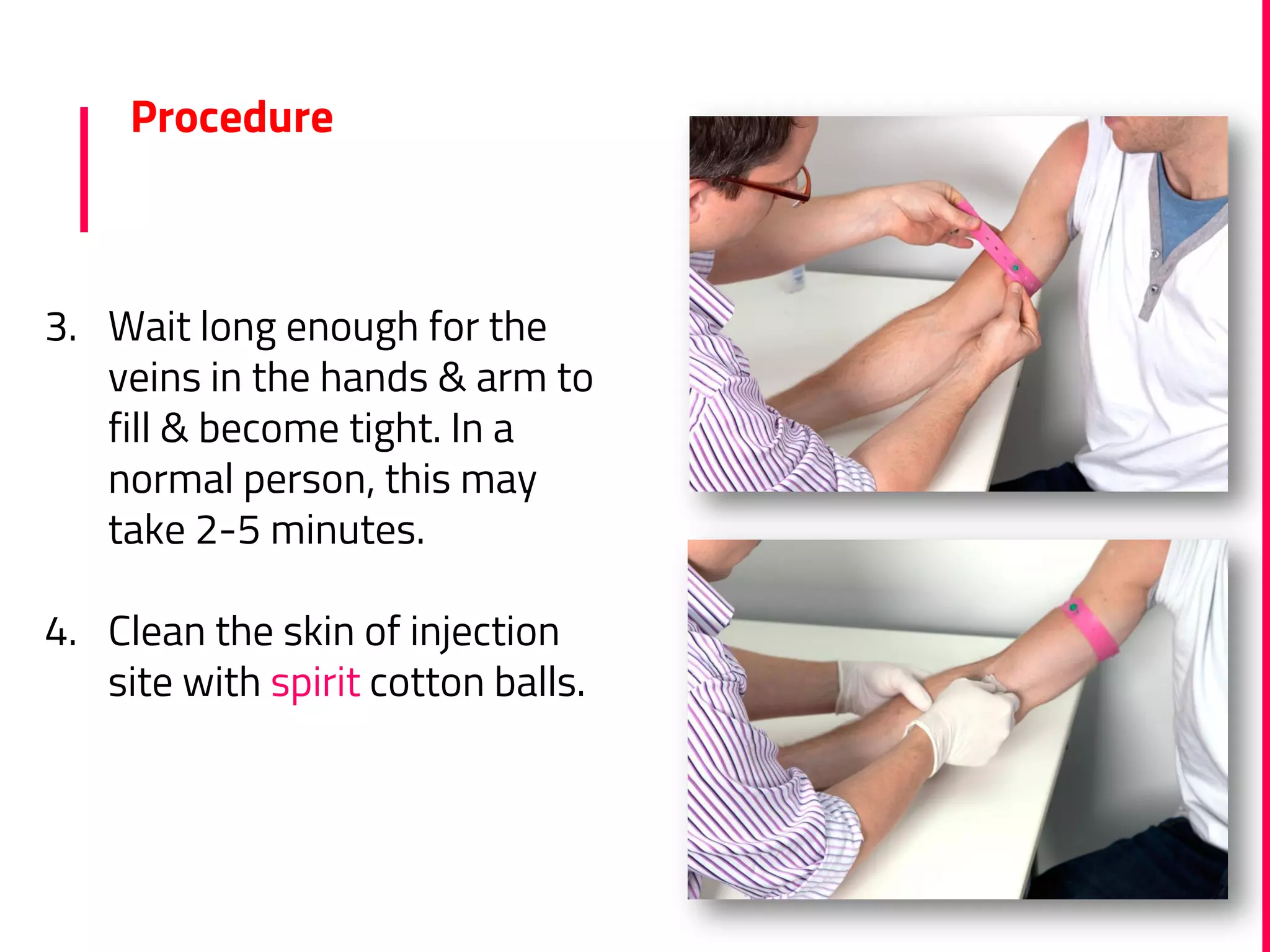 Safe iv cannulation (prevention of iv thrombophlebitis) | PDF