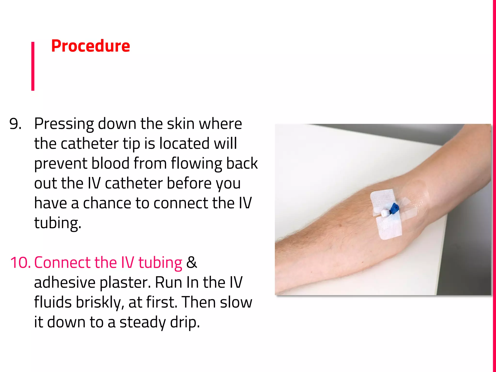 Safe iv cannulation (prevention of iv thrombophlebitis) | PDF