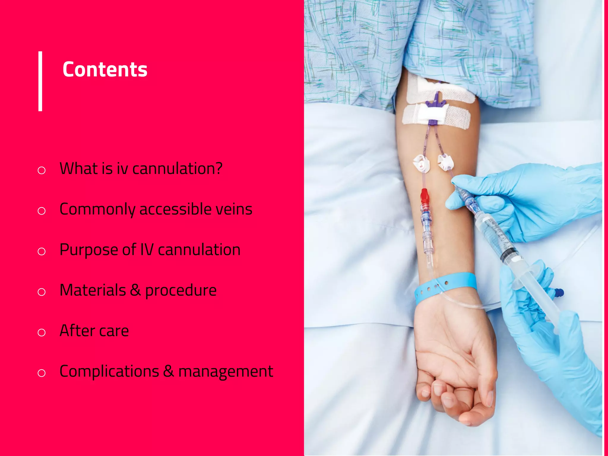 Safe iv cannulation (prevention of iv thrombophlebitis) | PDF