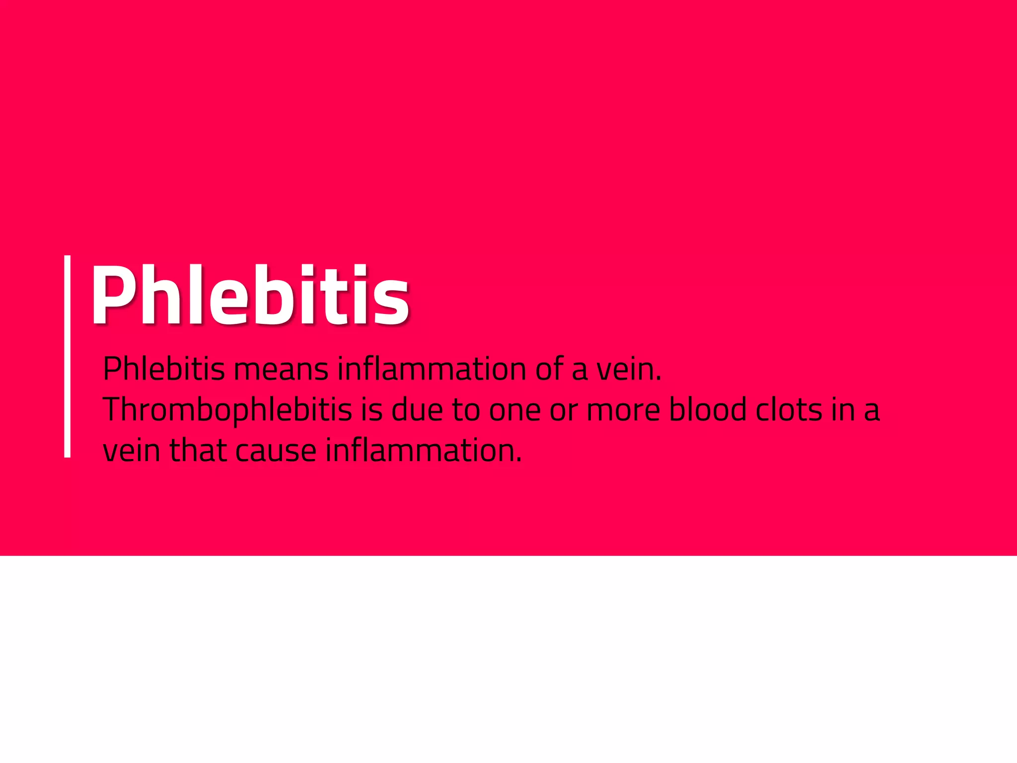 Safe iv cannulation (prevention of iv thrombophlebitis) | PDF