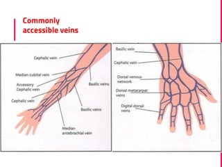 Safe iv cannulation (prevention of iv thrombophlebitis) | PDF